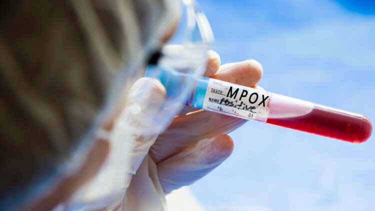 America fails to stop mpox and humankind in danger: Virus spreads ...